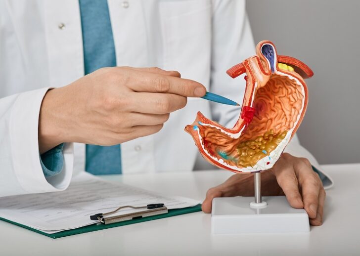 Gastrita: informații despre cauze, simptome, diagnostic și tratament